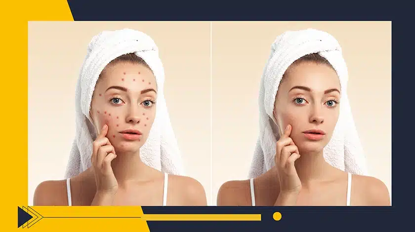 Photography Retouching: The Art of Improving Your Images